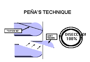 ANORECTAL ANOMALY - ANO IMPERFORADO - POSTERIOR SAGITTAL ANORECTOPLASTY ...